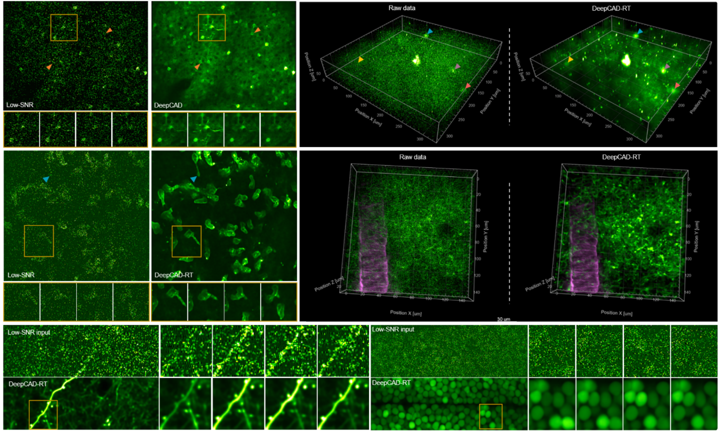 戴琼海、王好谦团队开发实时去噪方法实现超越光子噪声极限的超灵敏荧光成像
